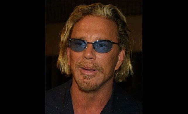 De tantas cirugías está irreconocible