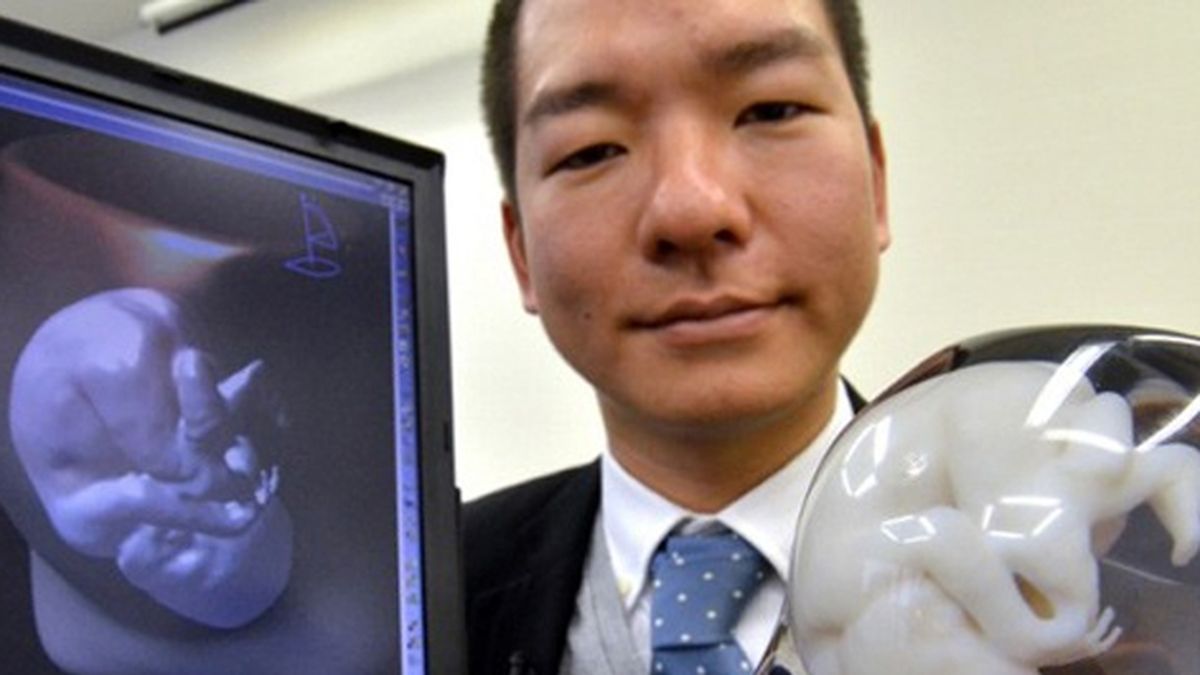 Conozca a su futuro bebé: crean un modelo 3D del feto de tamaño natural