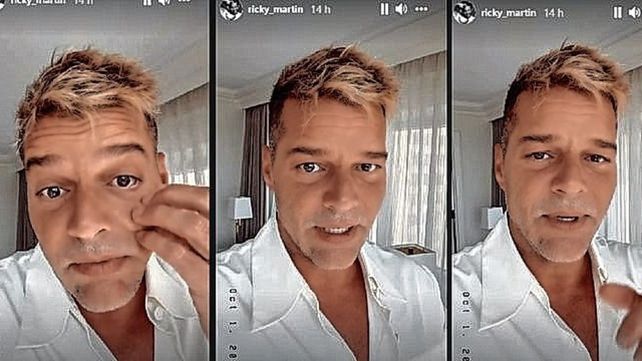 Ricky Martin habló de la supuesta cirugía estética en su cara