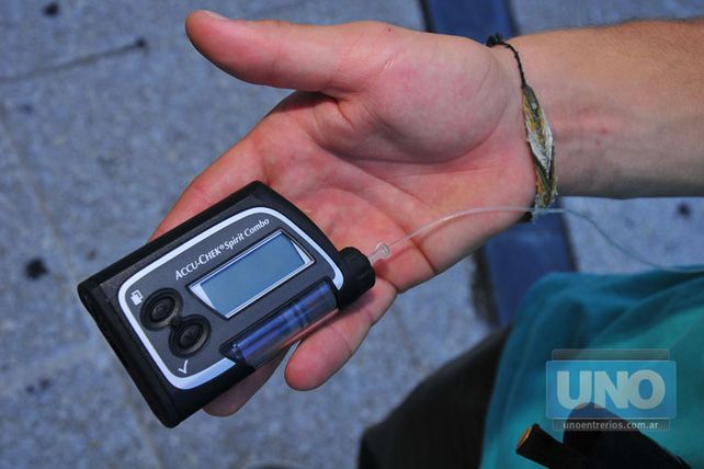 La bomba de insulina cambia la vida a personas con diabetes
