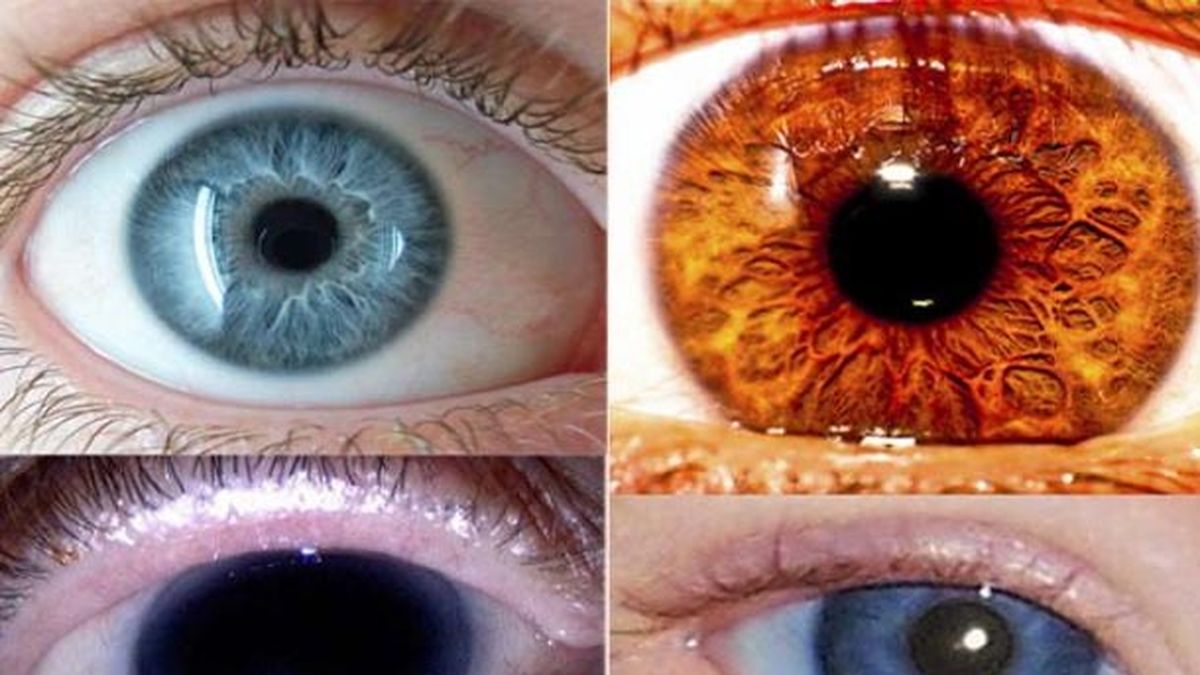 ¿Sabés de qué color son tus ojos realmente?
