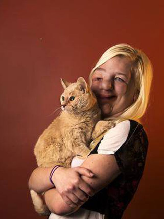 Sarah Atwell podrá volver a sonreir