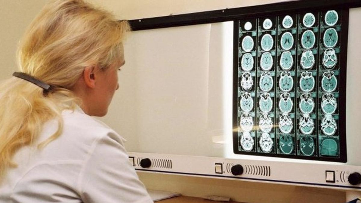 Día Mundial del ACV, un mal que ataca cada cuatro minutos