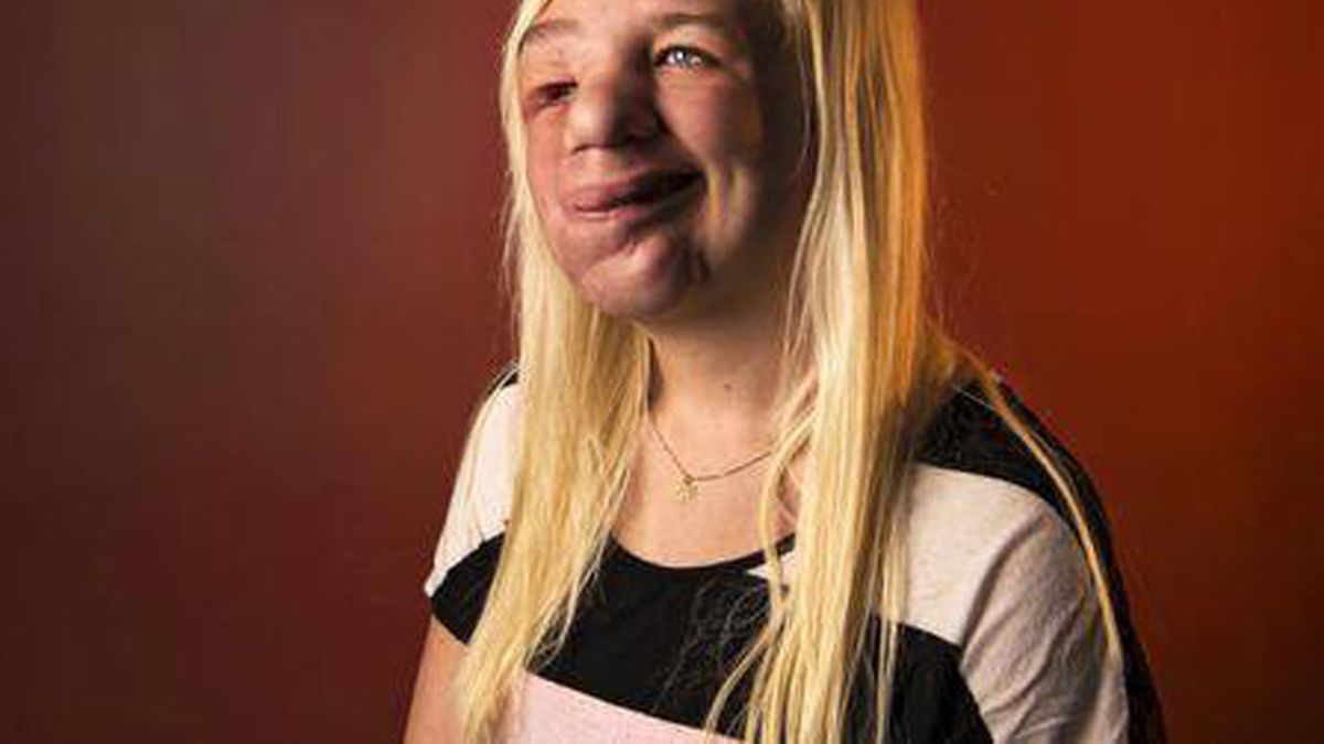 Sarah Atwell podrá volver a sonreir