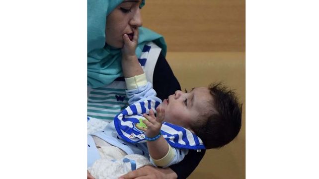 Operaron con éxito a un bebé que nació con ocho extremidades