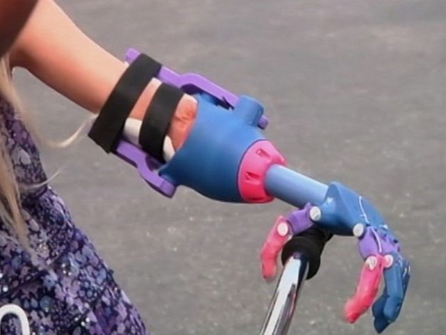 Impresión en 3D permite a niña tener prótesis de mano