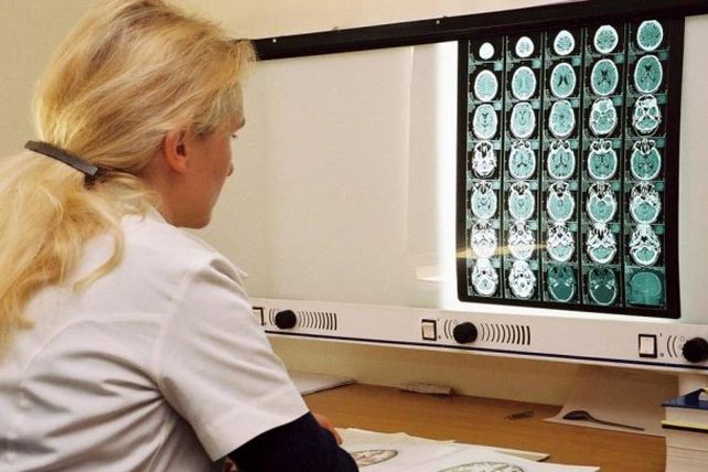 Día Mundial del ACV, un mal que ataca cada cuatro minutos