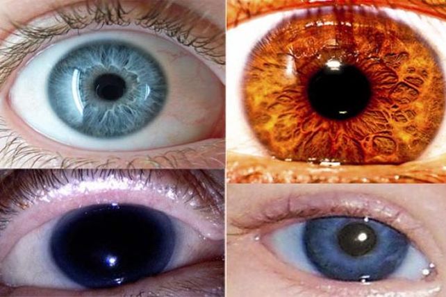 ¿Sabés de qué color son tus ojos realmente?