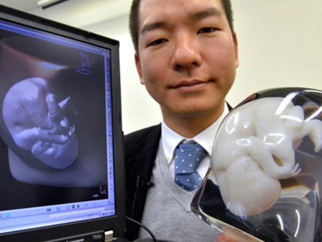 Conozca a su futuro bebé: crean un modelo 3D del feto de tamaño natural