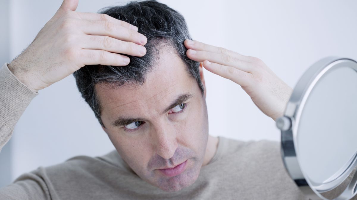 10 pasos de Hair Recovery para solucionar la pérdida de pelo