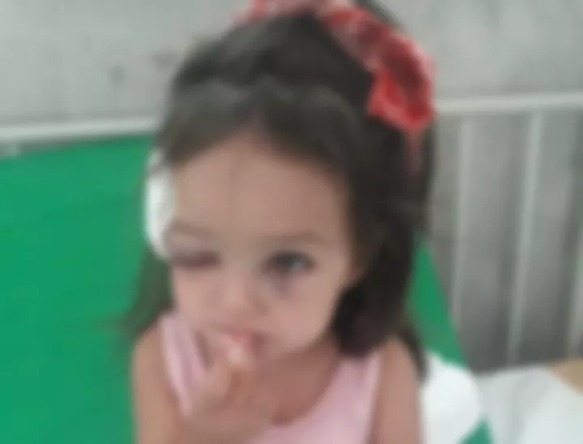 Una Niña De 2 Años Fue Brutalmente Golpeada Por Un Desconocido