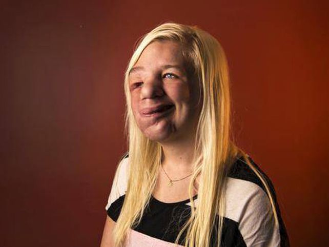 Sarah Atwell podrá volver a sonreir