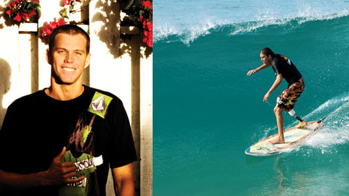 Mike Coots sobrevivió al ataque de un tiburón y aprovechó lo mejor de ...