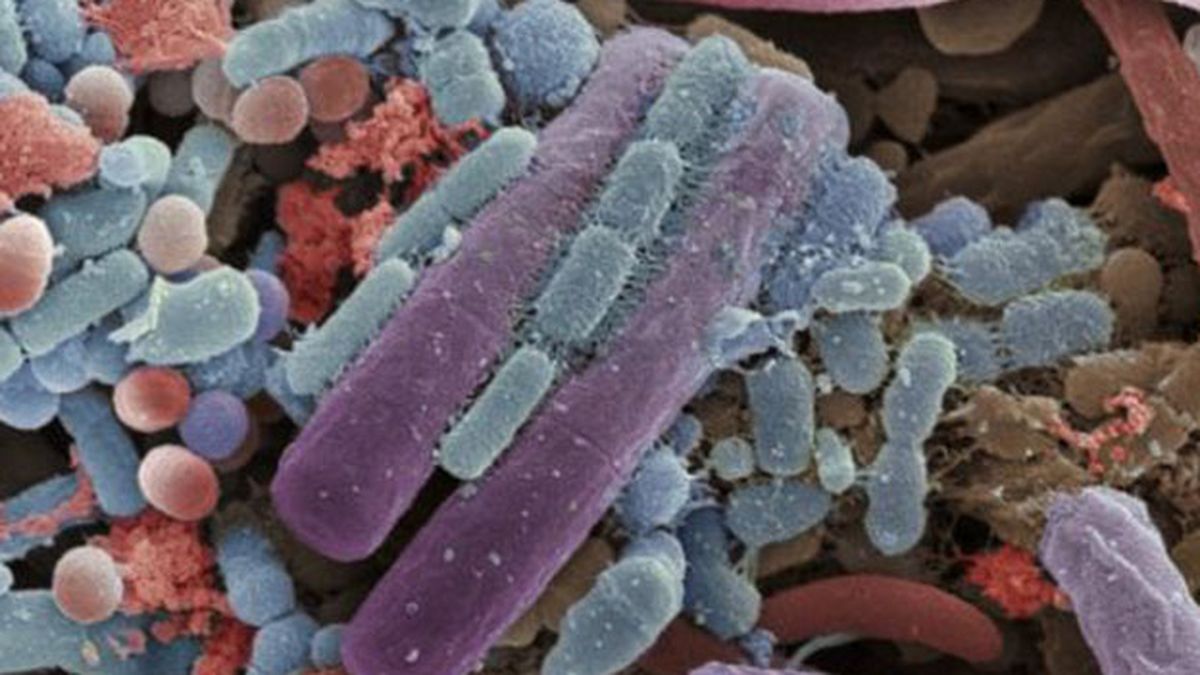 Increíbles imágenes de los microbios que nos rodean