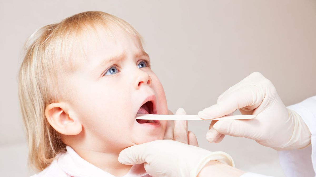 Faringoamigdalitis: piden uso de los test de diagnóstico rápido