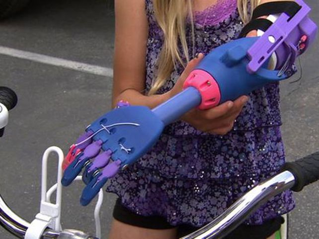 Impresión en 3D permite a niña tener prótesis de mano